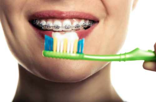 The Basics for Brushing Your Braces - Dabney Orthodontics